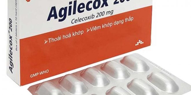 Chỉ định và chống chỉ định của thuốc Agilecox là gì?